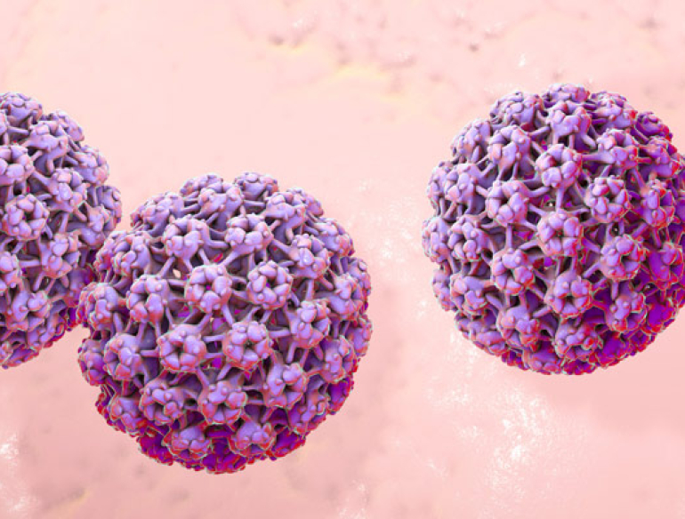 90 Decline In Genital Warts In Young Australians Kirby Institute